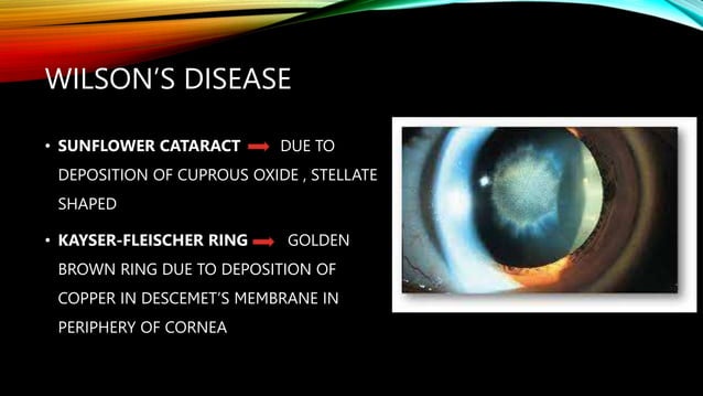 TYPES , SIGNS AND SYMPTOMS OF CATARACT.pptx
