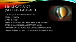 TYPES , SIGNS AND SYMPTOMS OF CATARACT.pptx