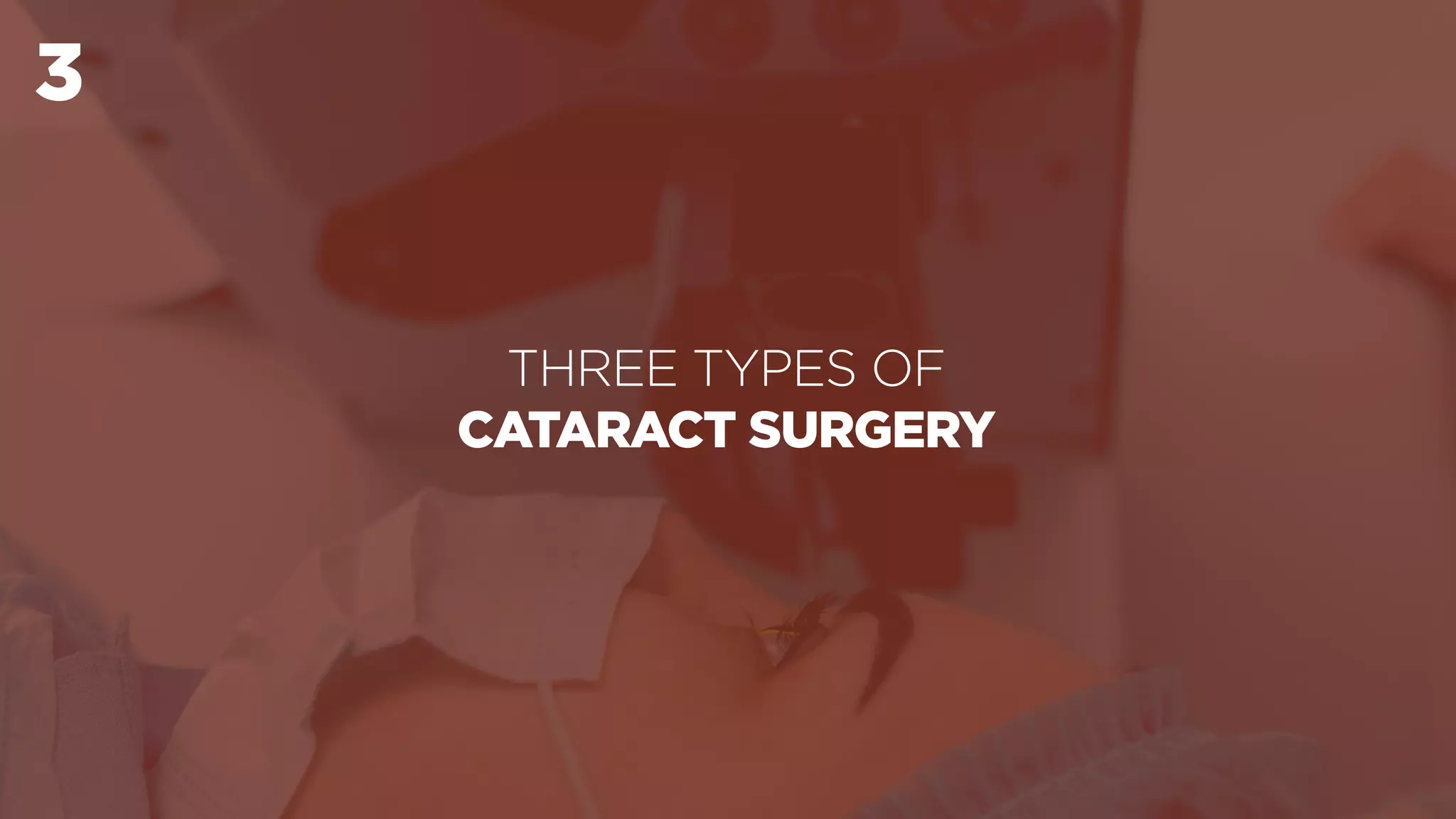 Types of Cataract Surgery.pdf