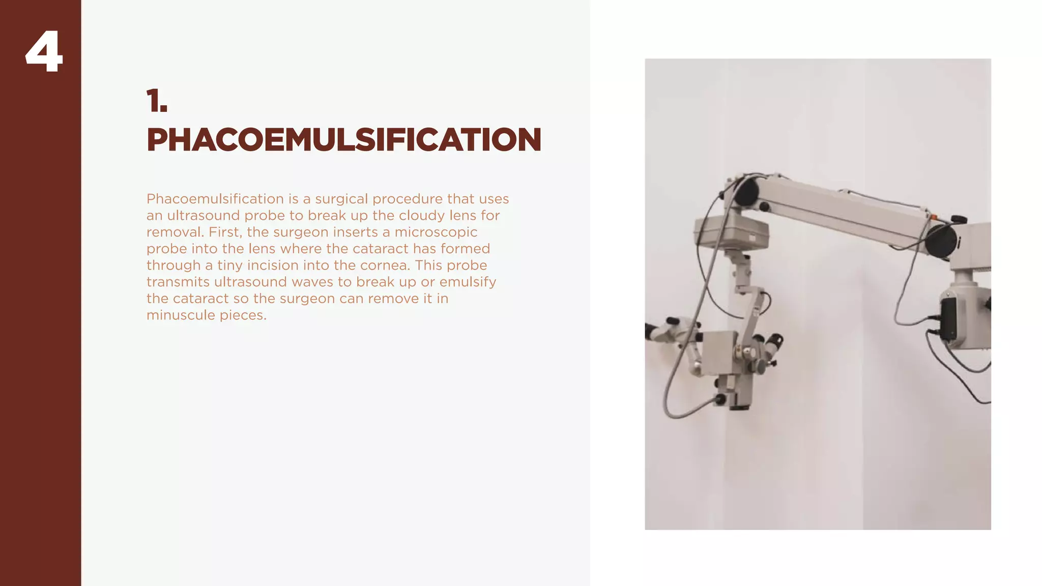 Types of Cataract Surgery.pdf