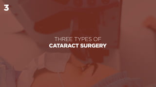 Types of Cataract Surgery.pdf