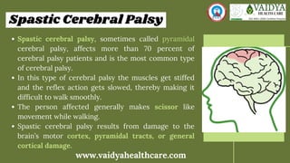 Types Of Cerebral Palsy | PPT