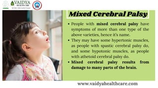 Types Of Cerebral Palsy | PPT