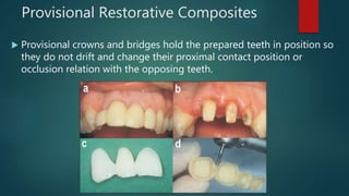 Types of Composites | PPTX