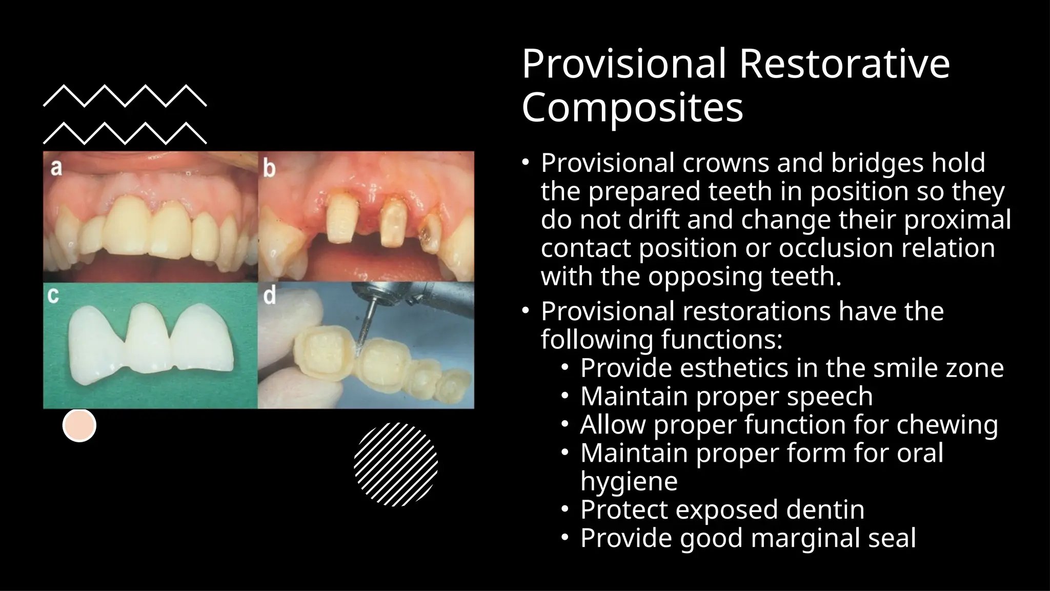 Types of composites used in dentistry 2024 | PPT
