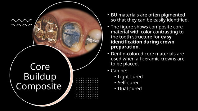 Types of composites used in dentistry 2024 | PPT