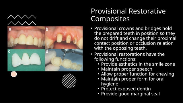 Types of composites used in dentistry 2024 | PPT