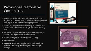 Types of composites used in dentistry 2024 | PPT