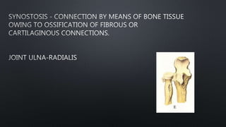 Types of connections in human | PPT