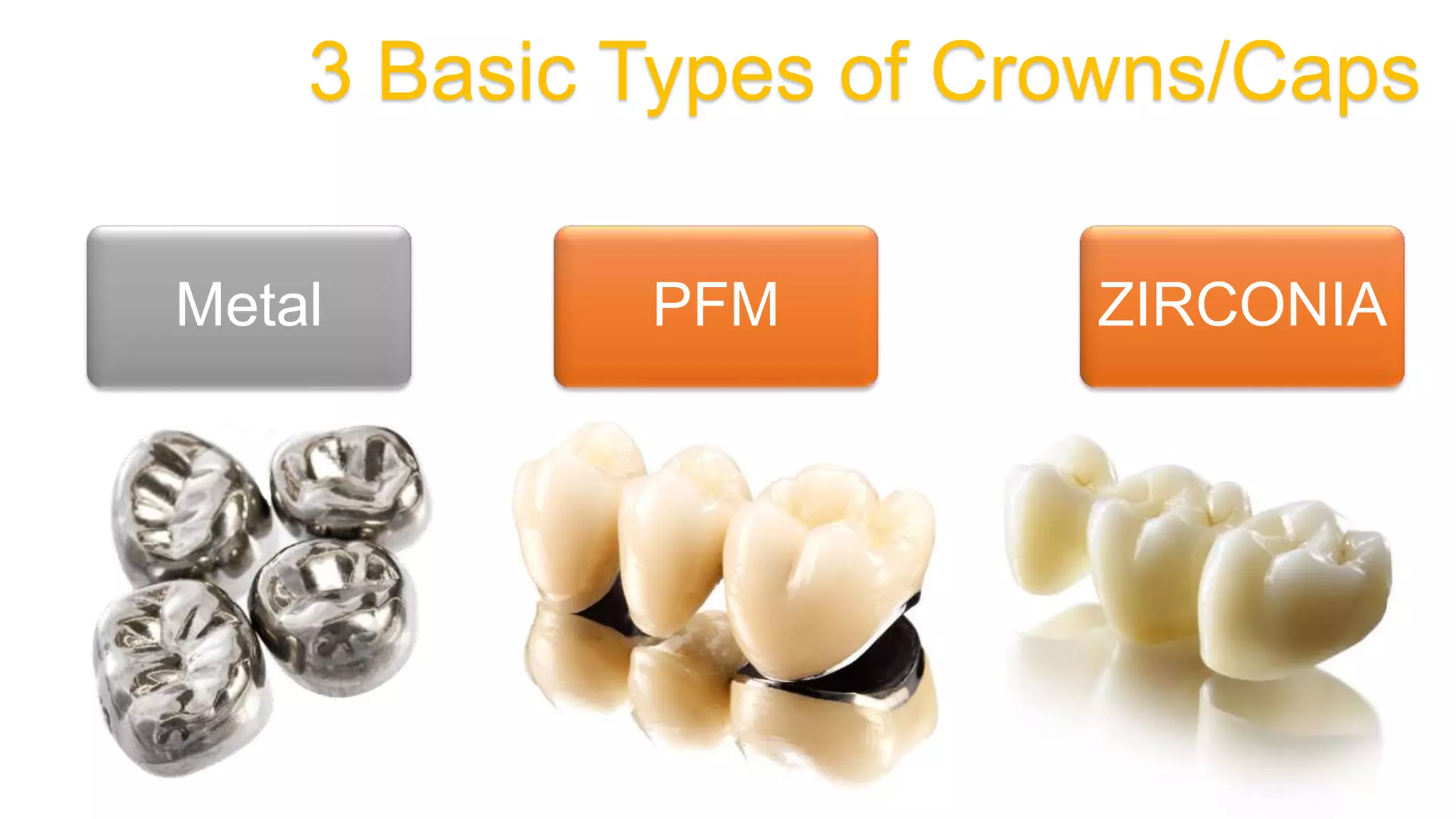 Types of Crowns UPload.pptx