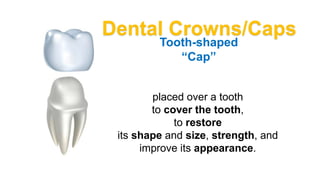 Types of Crowns UPload.pptx
