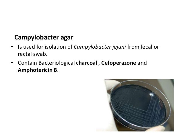 Types of culture media