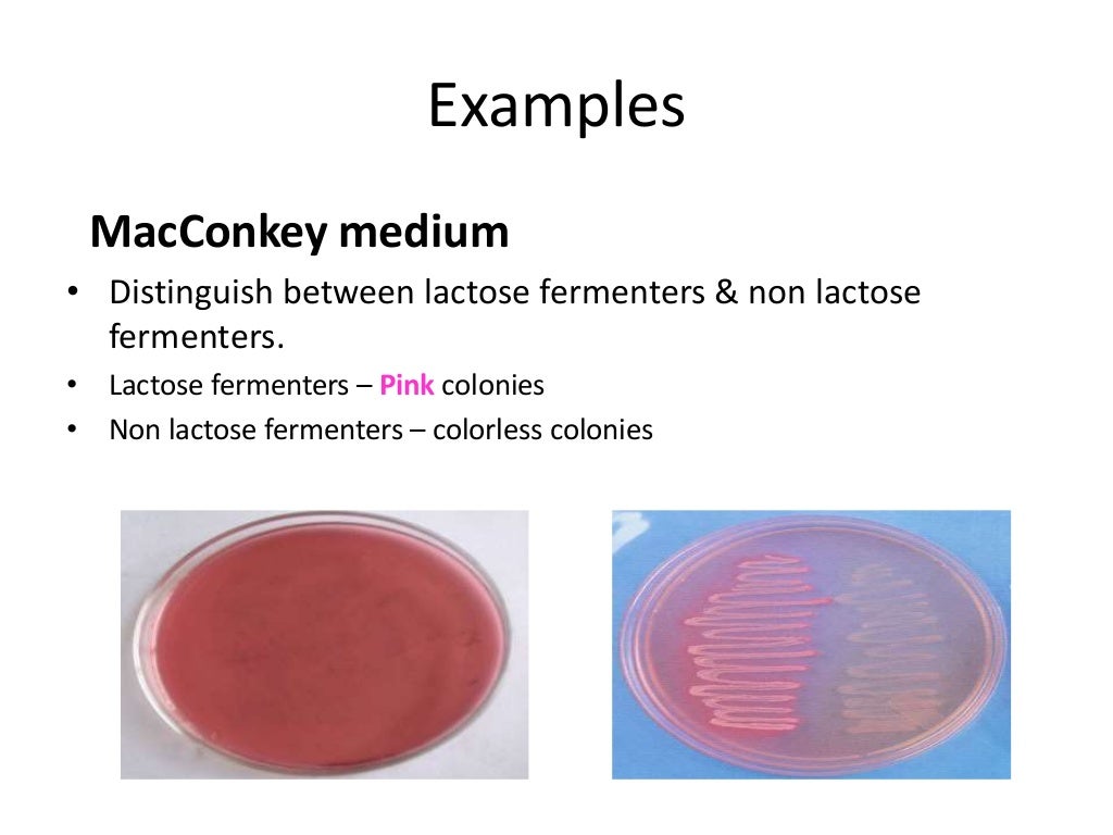 Types of culture media