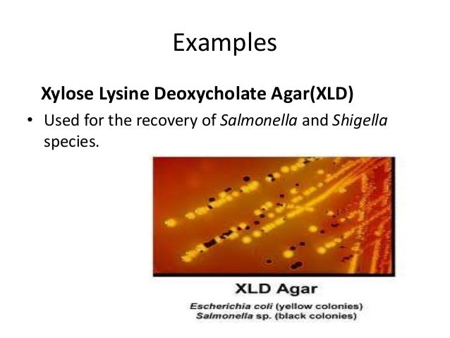 Xylose Lysine Deoxycholate Xld Agar Principle Uses