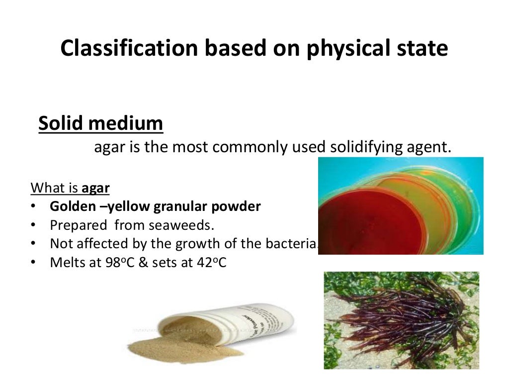 Types of culture media