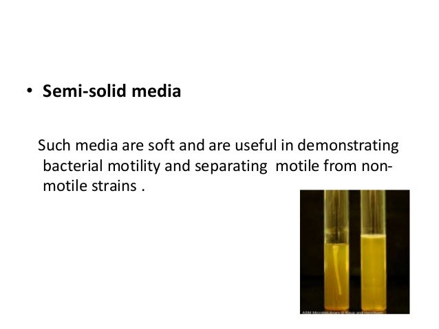 Types of culture media