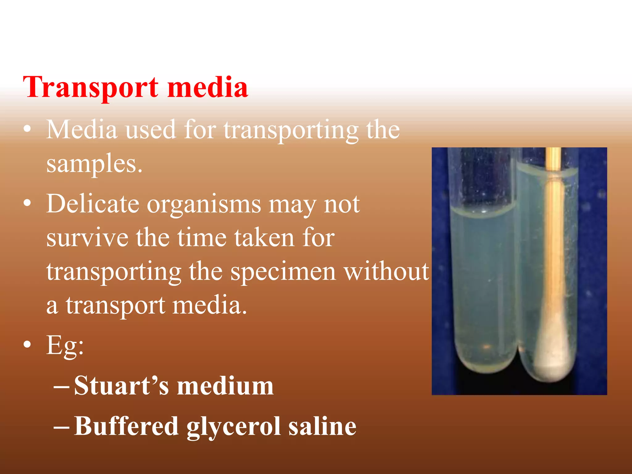 Types of culture media | PPTX