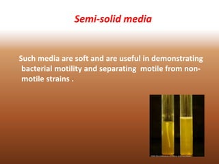 Types of culture media | PPTX