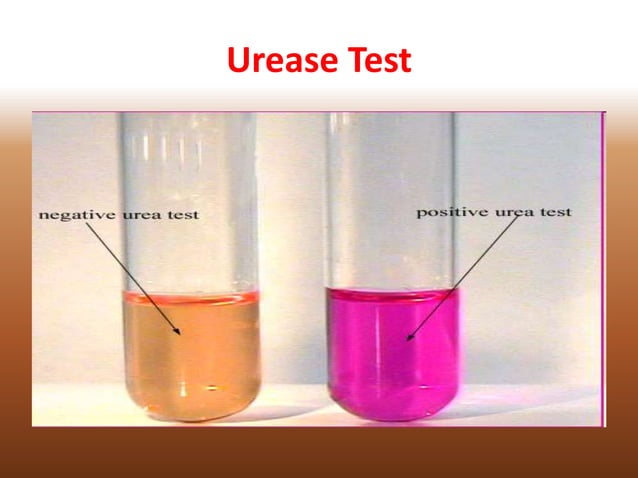 Types of culture media | PPT