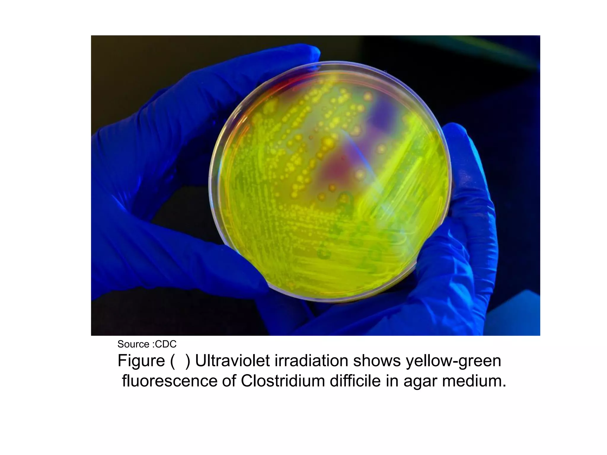 Types of culture media clostridium difficile agar.pptx5 | PDF