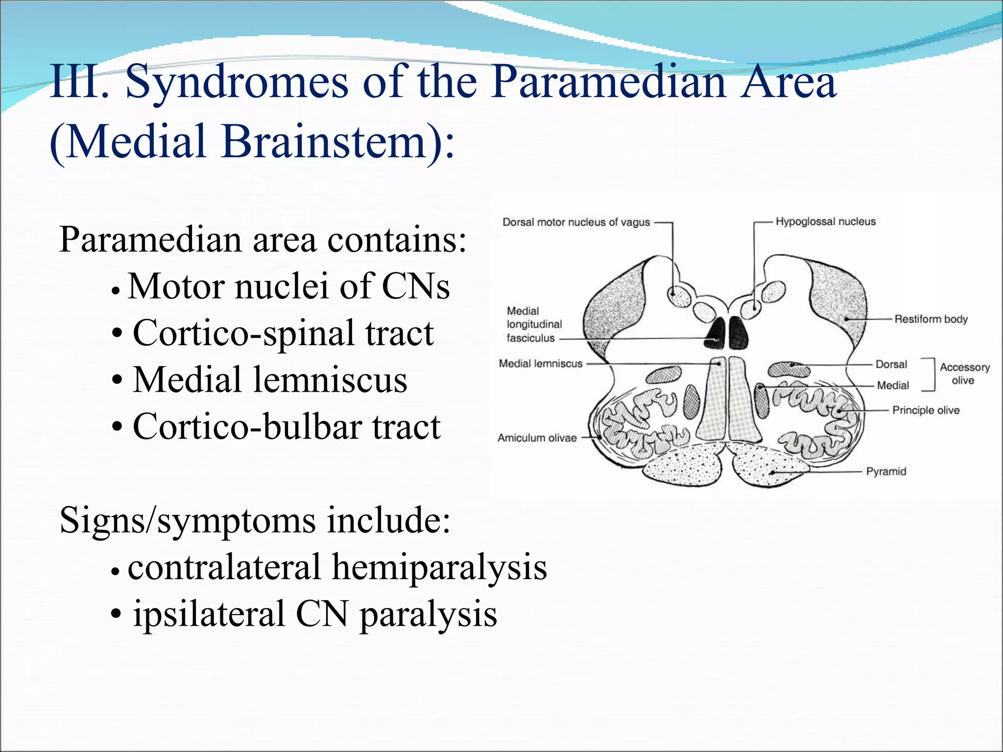 Types of cva and stroke syndromes | PPTX