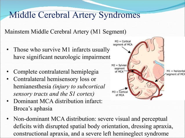 Types of cva and stroke syndromes