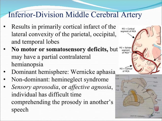 Types of cva and stroke syndromes