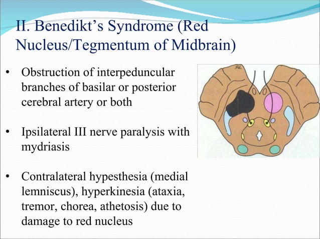 Types of cva and stroke syndromes