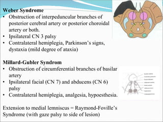 Weber Syndrome Midbrain