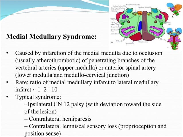 Types of cva and stroke syndromes