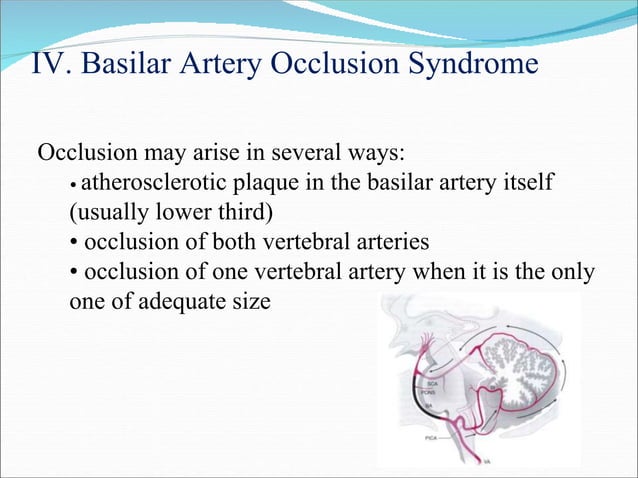 Types of cva and stroke syndromes