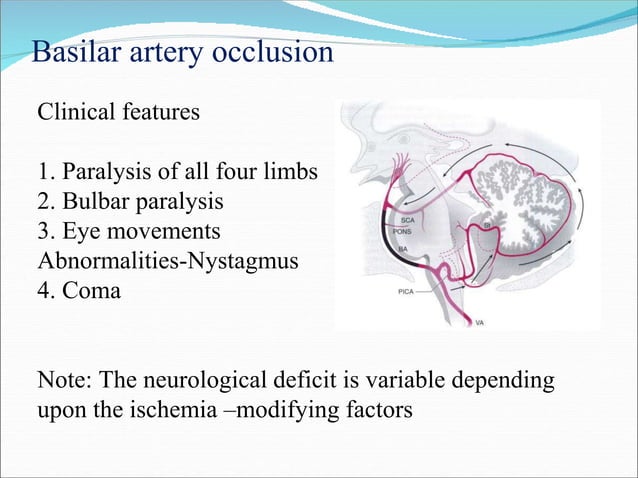 Types of cva and stroke syndromes