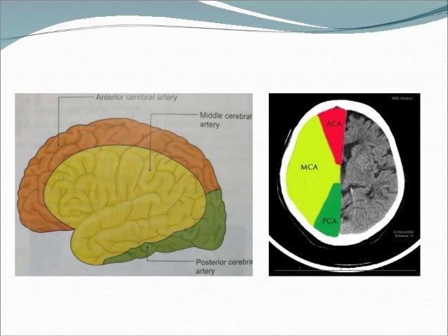 Types of cva and stroke syndromes