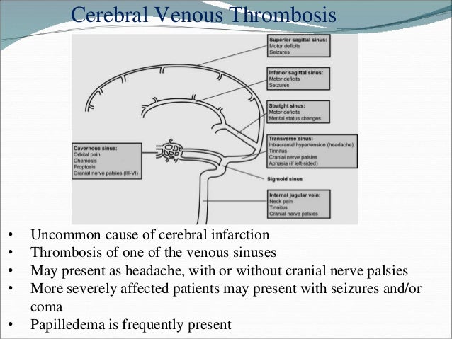 Types of cva and stroke syndromes