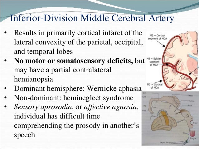 Types of cva and stroke syndromes
