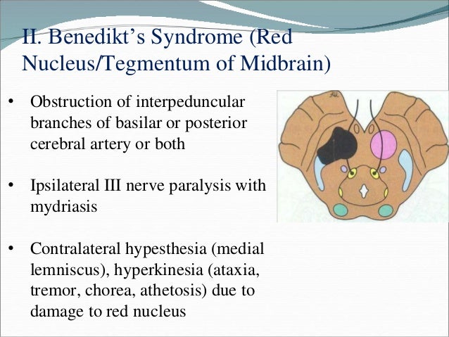 Types of cva and stroke syndromes