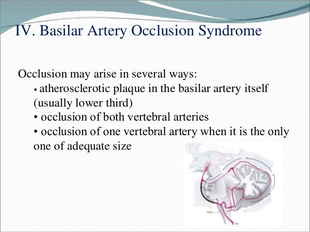 Types of cva and stroke syndromes