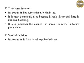 Types of delivery And Physiotherapy management after c-section.pptx