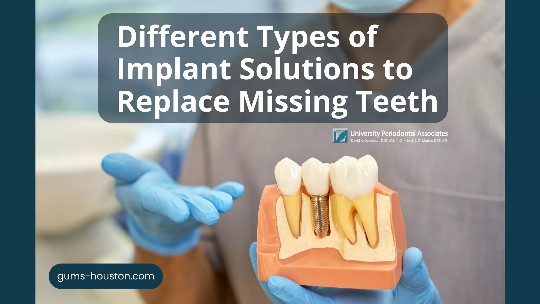 Types of dental implants to replace your missing teeth | PDF