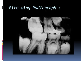 Types of dental radiographs in children | PPTX