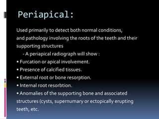 Types of dental radiographs in children | PPTX