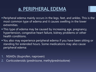 Types of EDEMA-28,30,38.pptxuvgvvugvbhbhbh hjb | PPT