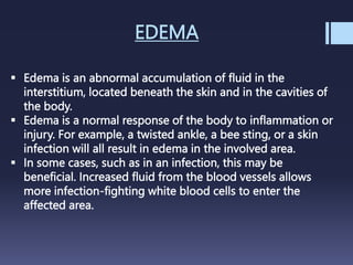 Types of EDEMA-28,30,38.pptxuvgvvugvbhbhbh hjb | PPT