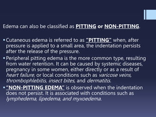 Types of EDEMA-28,30,38.pptxuvgvvugvbhbhbh hjb | PPT