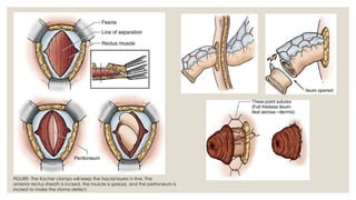 Types of enterostomy and its indications and complications.pptx