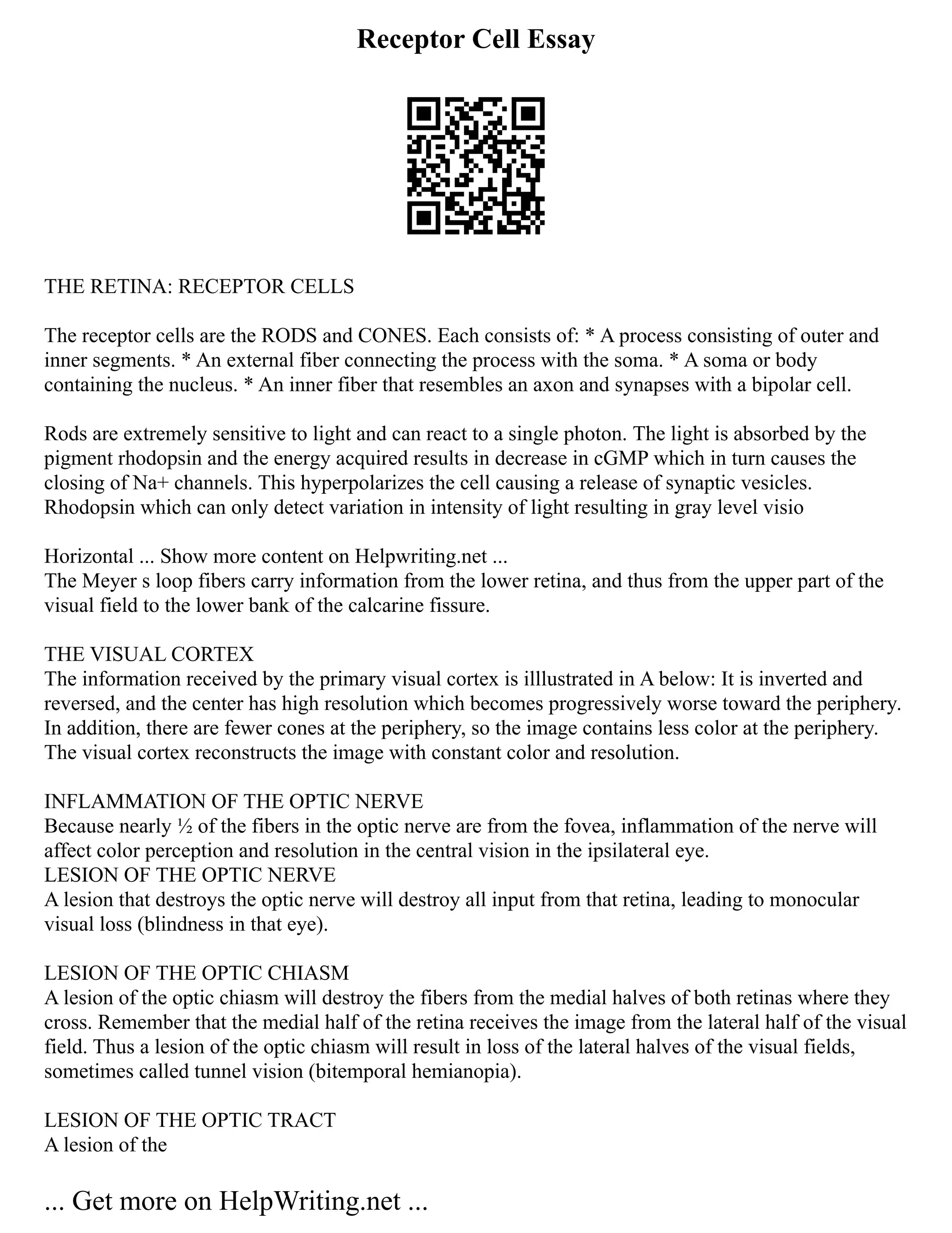 Types Of Essay Writing With Examples Telegraph | PDF