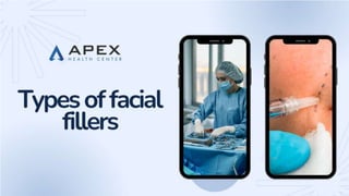 Types of facial fillers.pptx