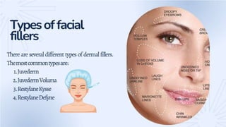 Types of facial fillers.pptx