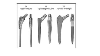 TYPES OF FEMORAL STEMS.pptx for arthropoasty | PPT