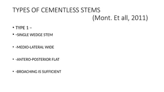 TYPES OF FEMORAL STEMS.pptx for arthropoasty | PPTX
